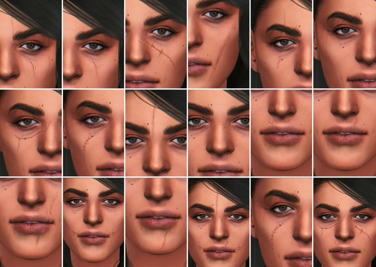 Sims 4 Scars CC: 29+ Body, Acne, and More Scar Mods