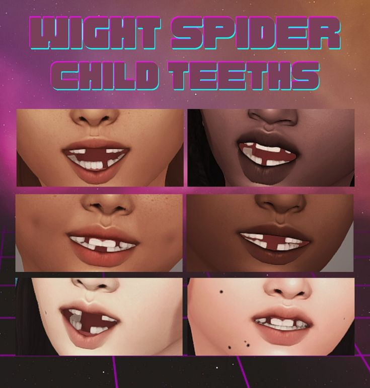 25+ Sims 4 Teeth CC and Mods (Replacement, Overlay, and More)