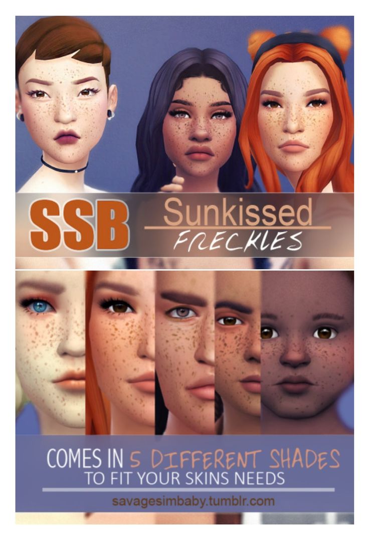 39 Sims 4 Freckles CC and Mods (Updated 2026!)